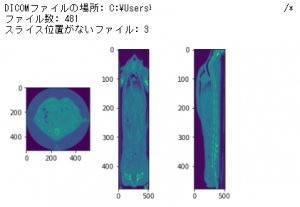PythonでCTのDICOMデータを表示する方法(MPRで3次元) - 獣医 x プログラミング