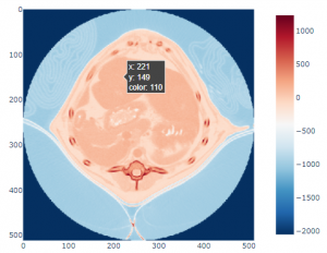 PythonでCTのDICOMデータを表示する方法(MPRで3次元) - 獣医 x プログラミング